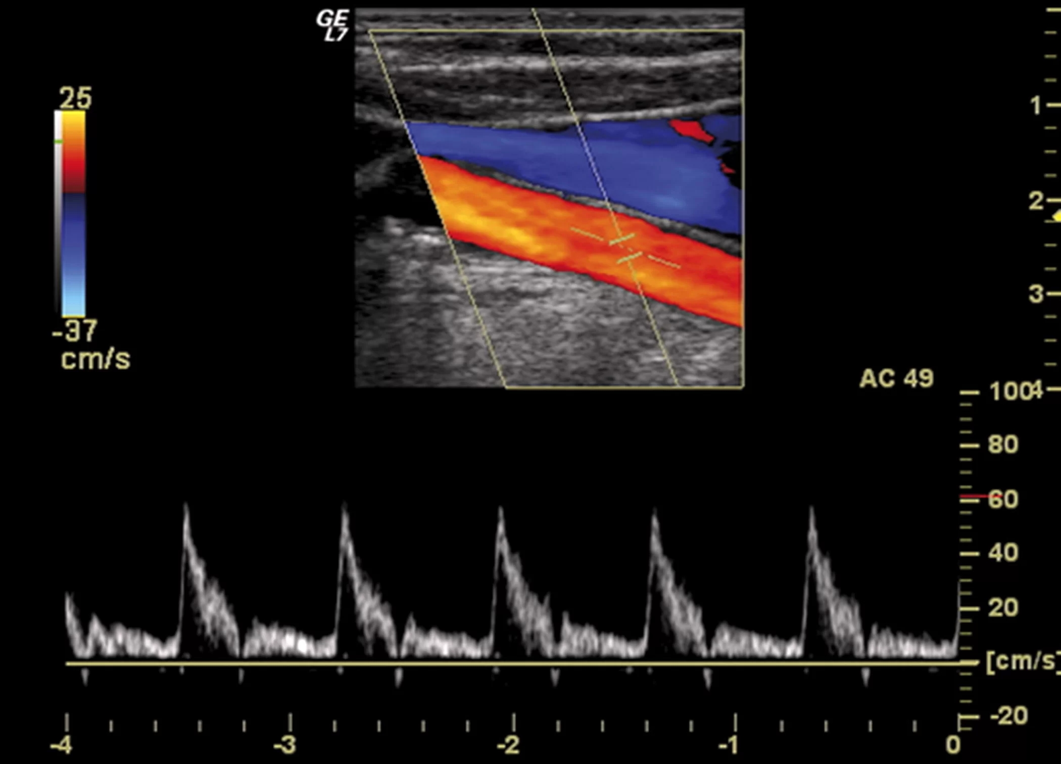 Ecodoppler Artero-Venoso Arti - Istituto Galeno